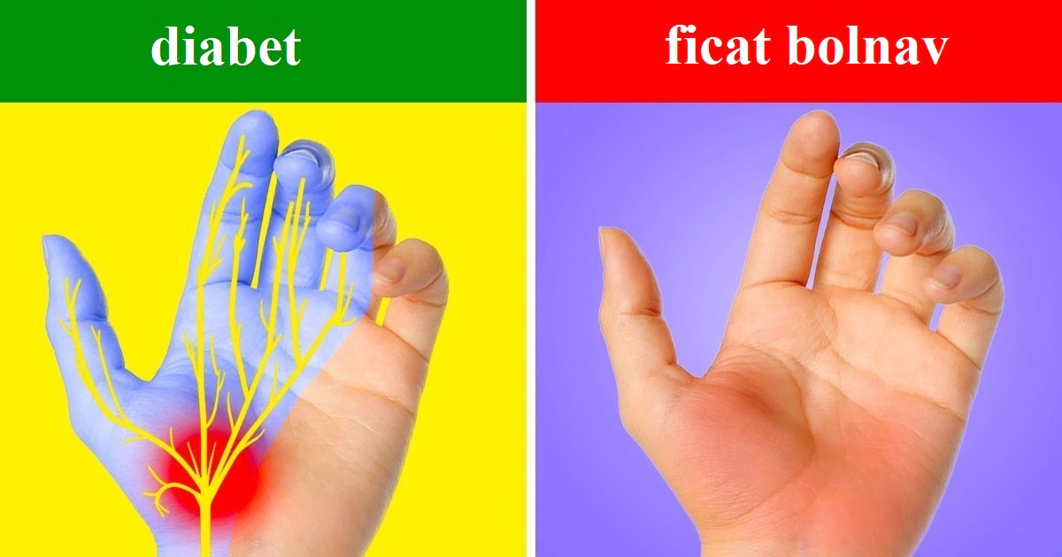 7 lucruri pe care le spun mâinile despre sănătatea ta