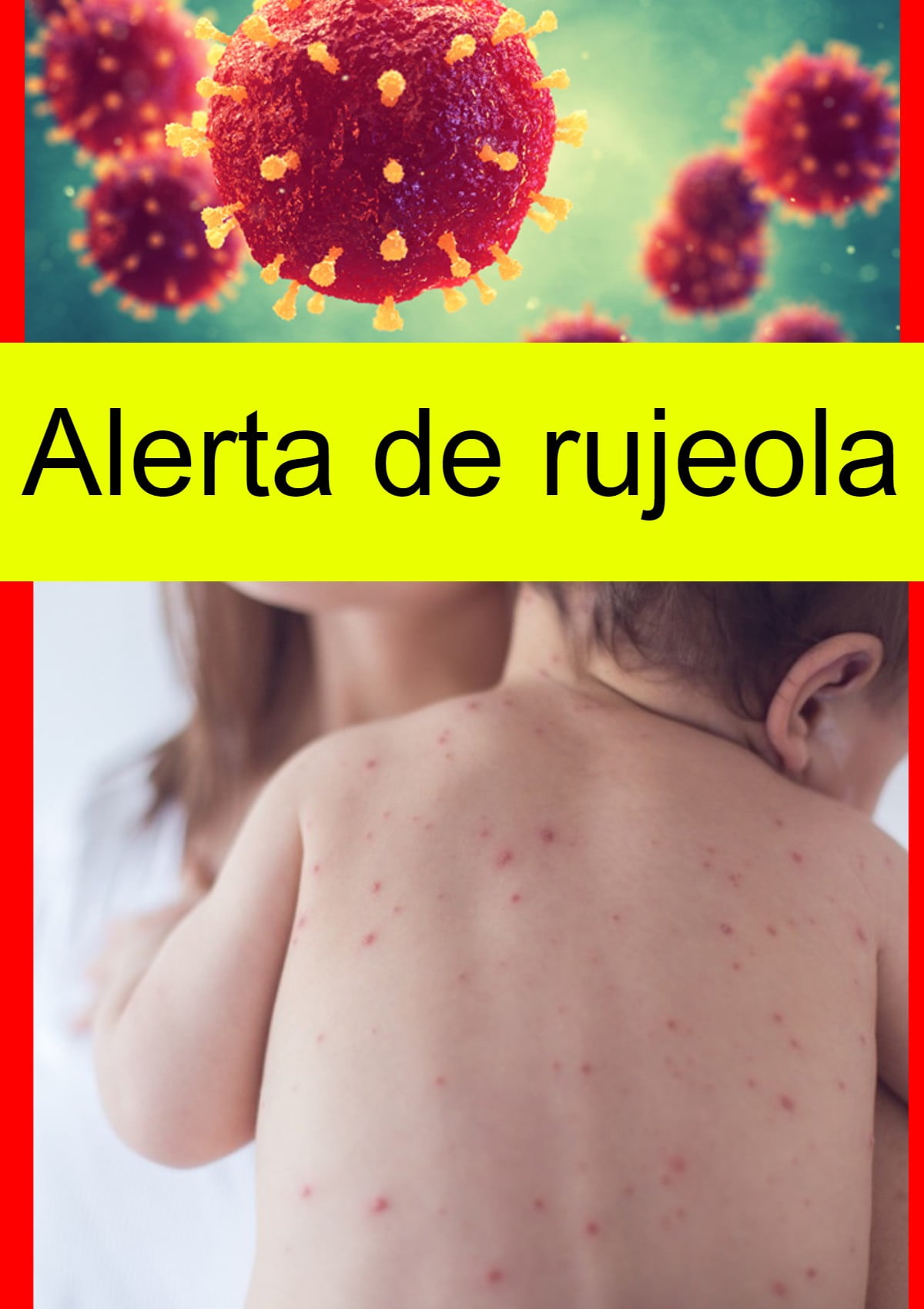 Alertă de rujeolă în România! Cum îți protejezi copilul