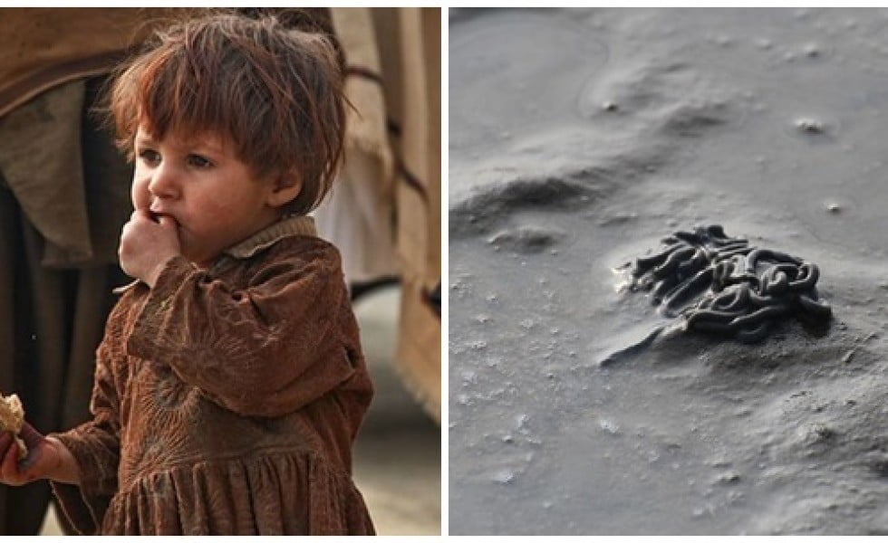 Remedii naturiste contra viermisorilor la copii