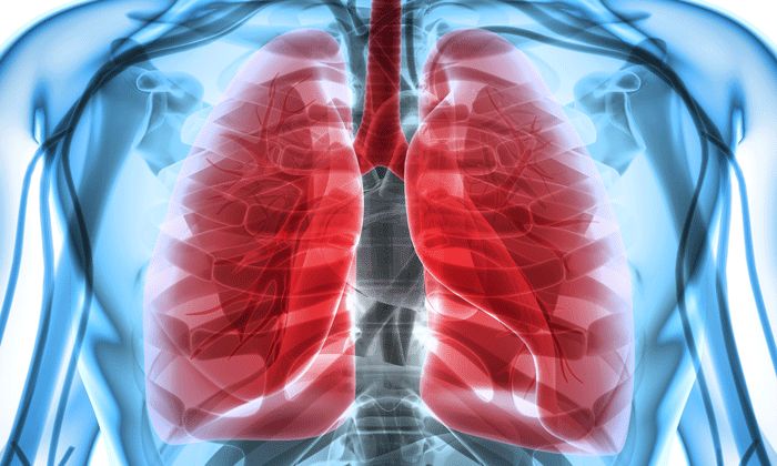 Ce trebuie să știi despre pneumonia care duce la cicatrizarea ...