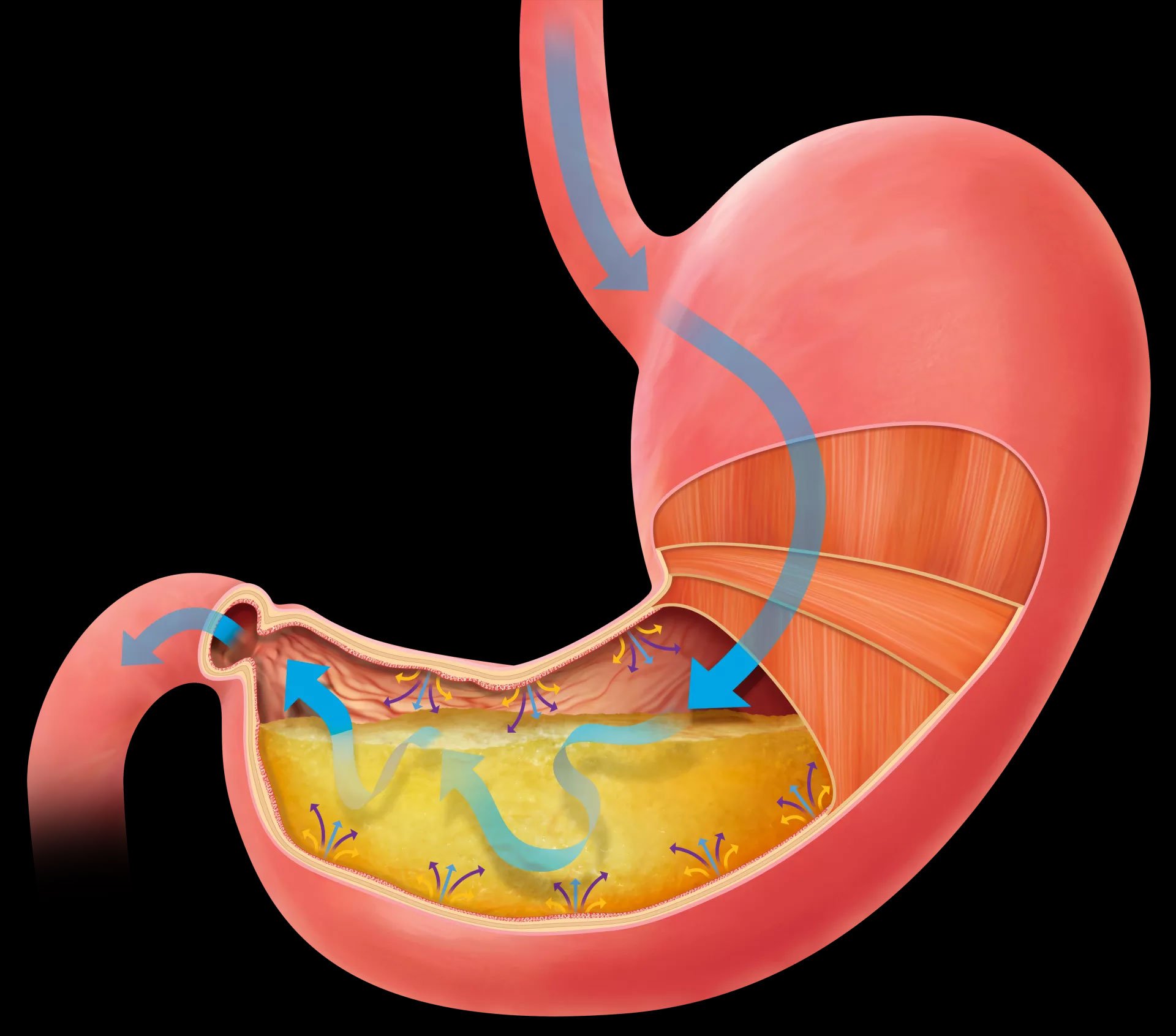 Heliobacter Pylori: Simptome, Diagnostic și Opțiuni de Tratament